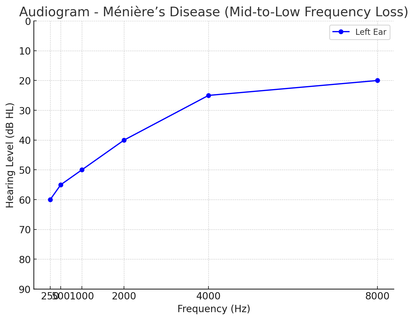 Understanding Meniere’s Disease | The Vertigo Co